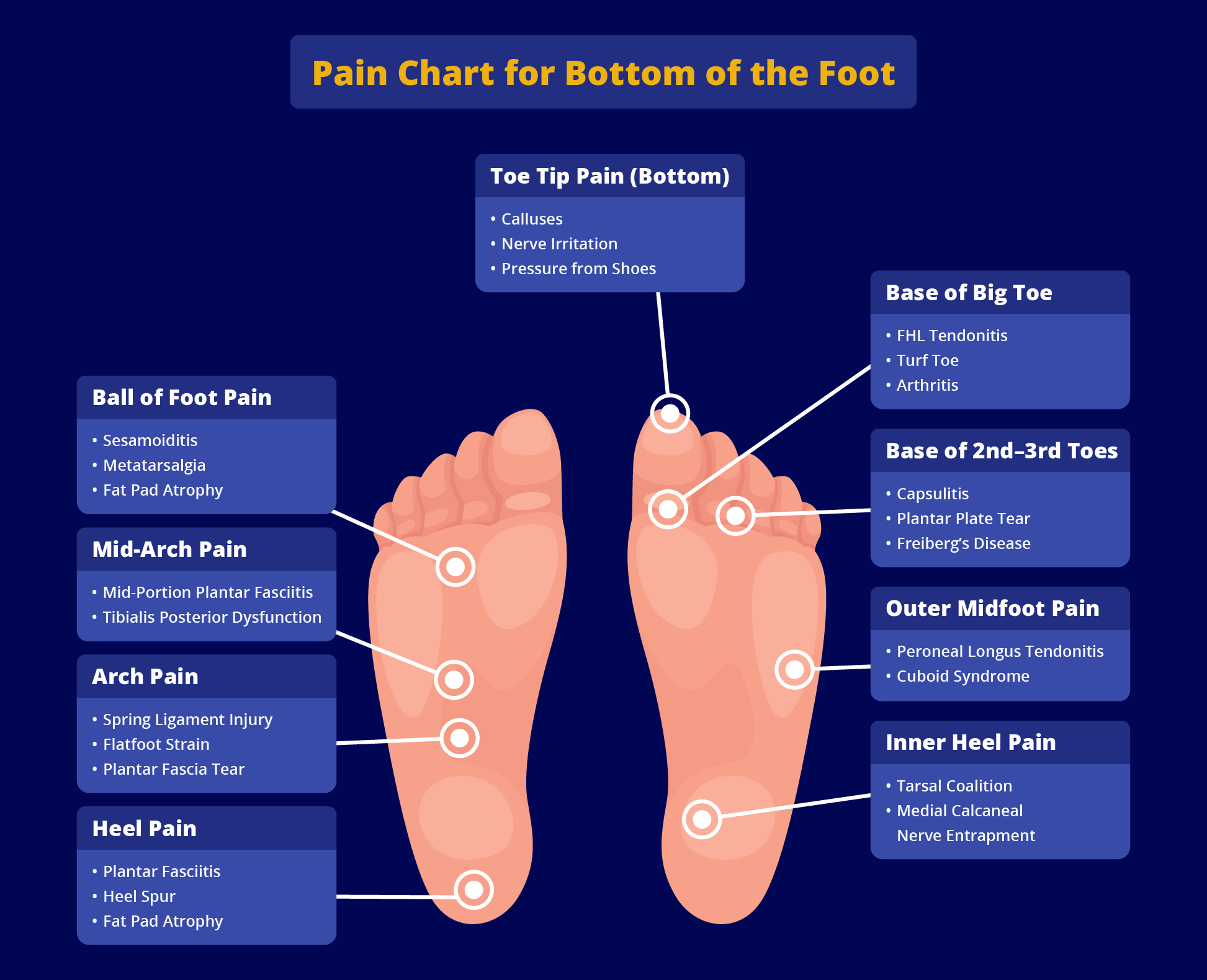 Foot Pain Chart: What Your Pain Location Might Mean