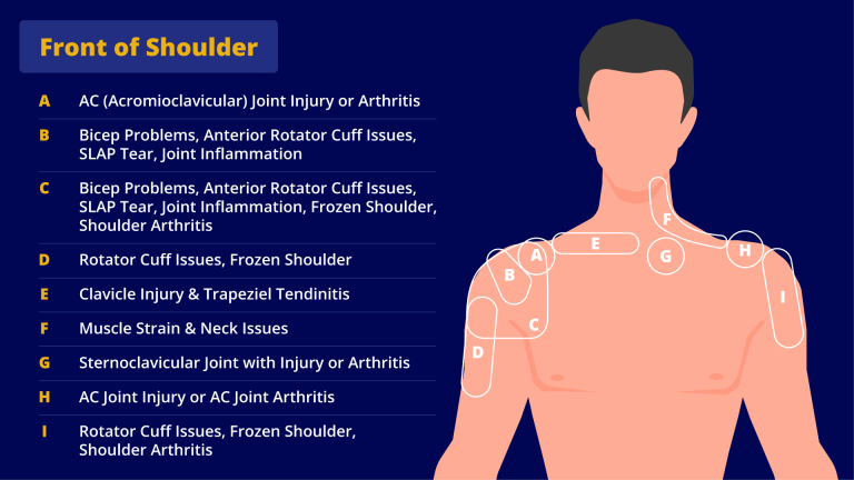 Shoulder Pain Diagnosis Chart and Causes by Area