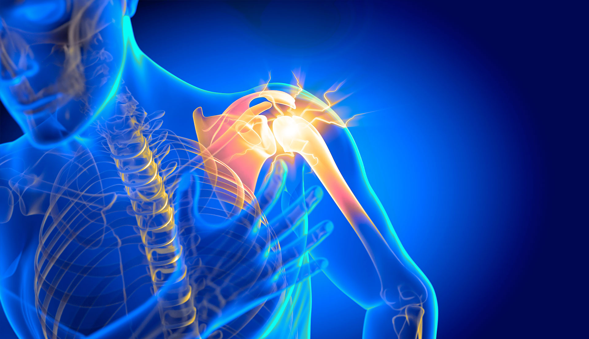 Shoulder Pain Diagnosis Chart And Causes By Area
